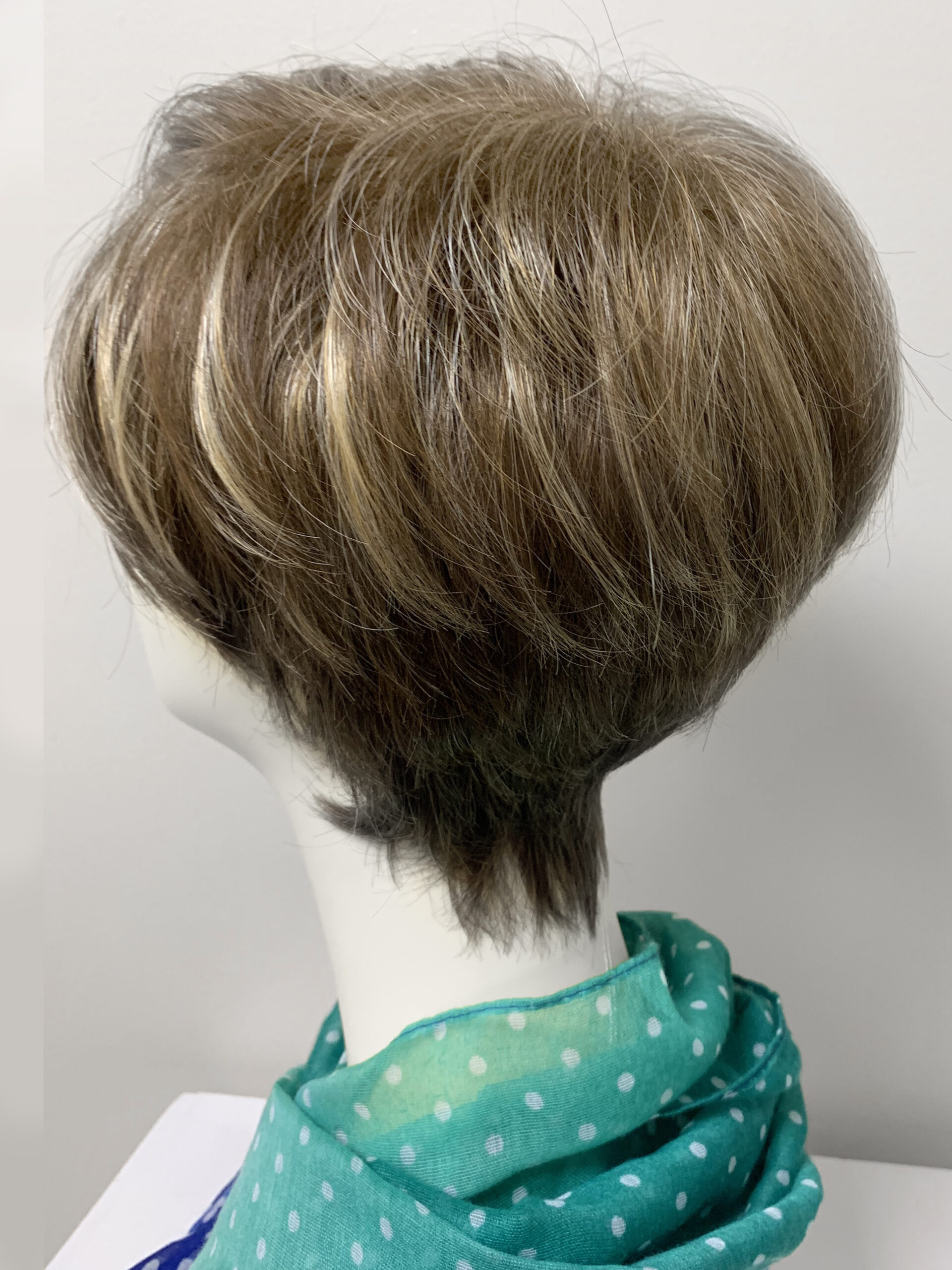 Hair Restoration – Hair Symmetry